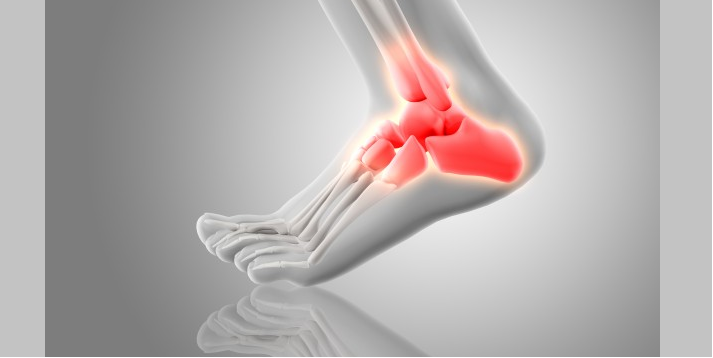 Reuma: wat het is en de invloed ervan op uw mobiliteit